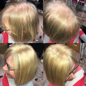 Hair Replacement Systems | Mesh Integration System | Angel Hair Extensions