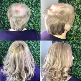 Hair Replacement Systems | Mesh Integration System | Angel Hair Extensions